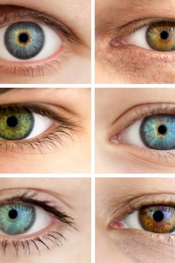 Custom Lasik Surgery - Specialty Eye MDs